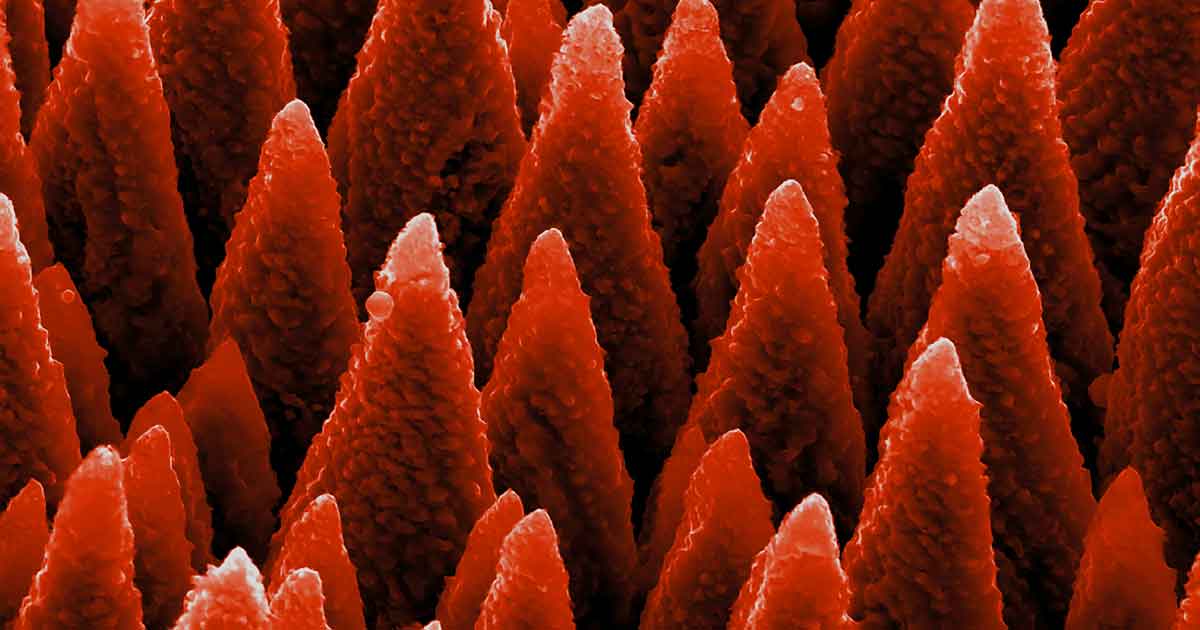 SCI - Recent Advances in Surface Analysis