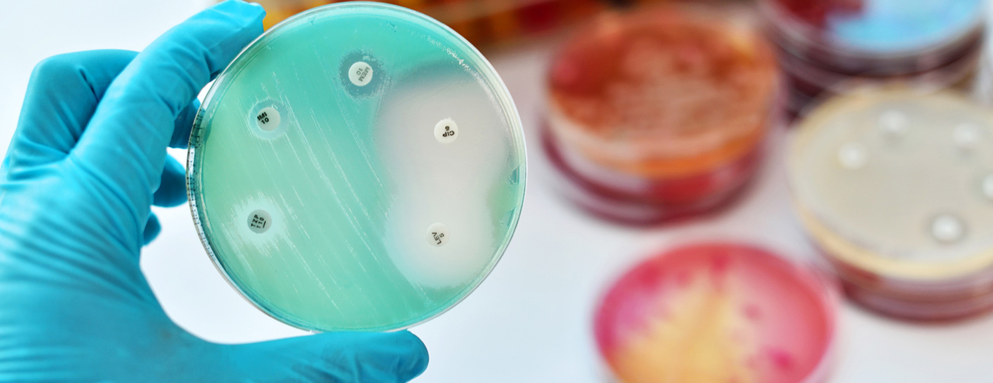 SCI News - Combating bacteria’s fight against antibiotics