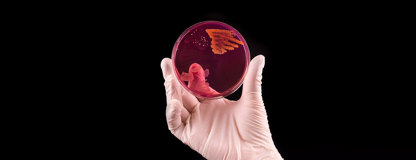 SCI News - New hope for staph vaccines as scientists identify new target